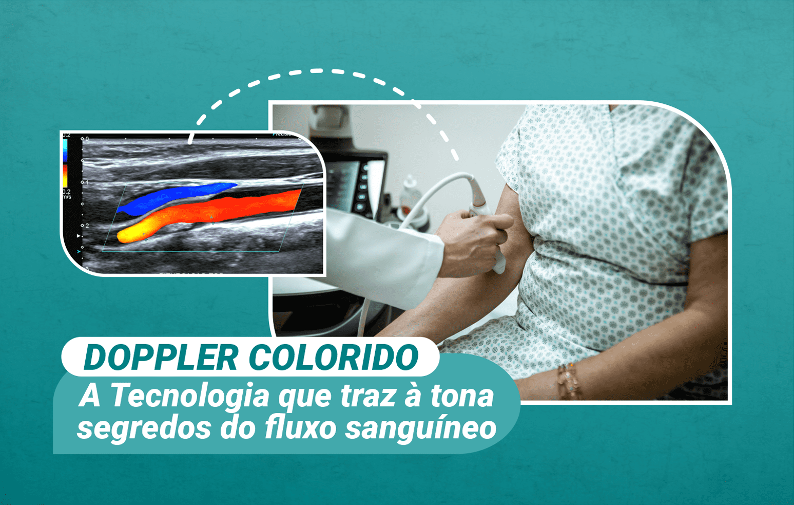 Doppler Colorido: A Tecnologia que Traz à Tona Segredos do...